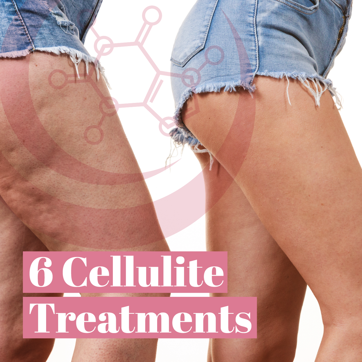 [6] CELLULITE TREATMENTS: WHAT REALLY WORKS? – cellu-lite.com